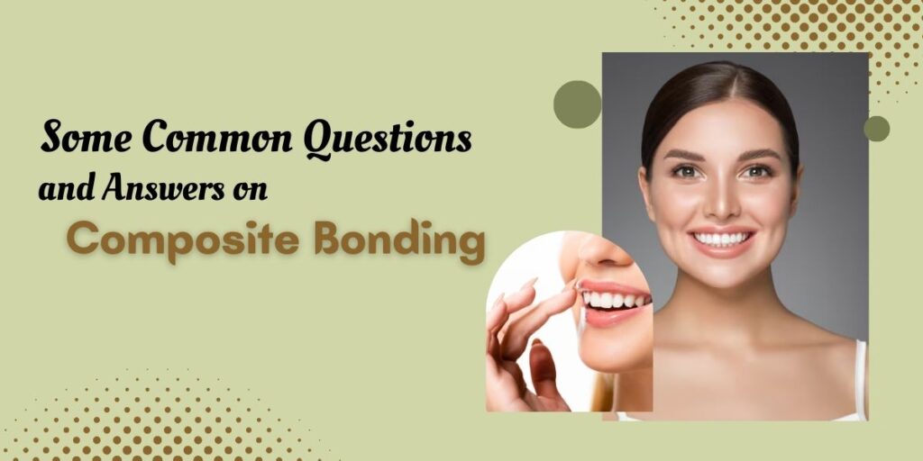 Some Common Questions and Answers on Composite Bonding - KnowFromBlog